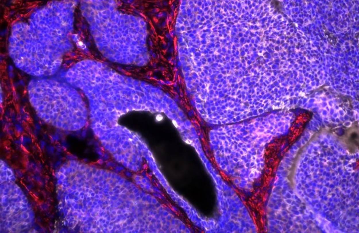 Nanopartículas para el tratamiento y seguimiento de la inmunoterapia ...